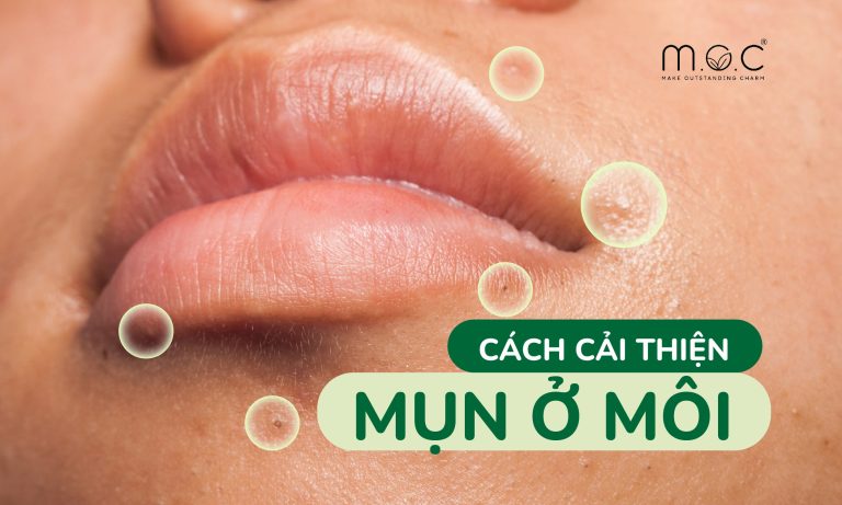 Mụn môi: Nguyên nhân và cách cải thiện